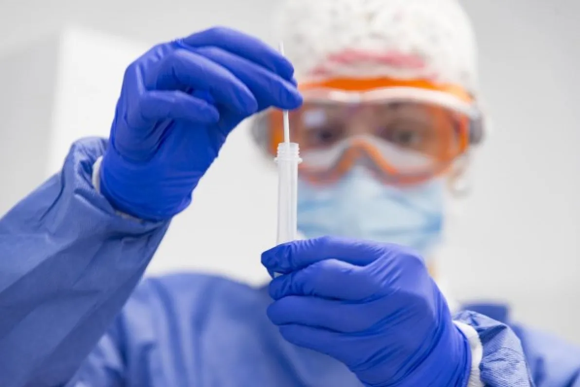 IMED realiza conjuntamente antígenos y PCR para un diagnóstico rápido y ...